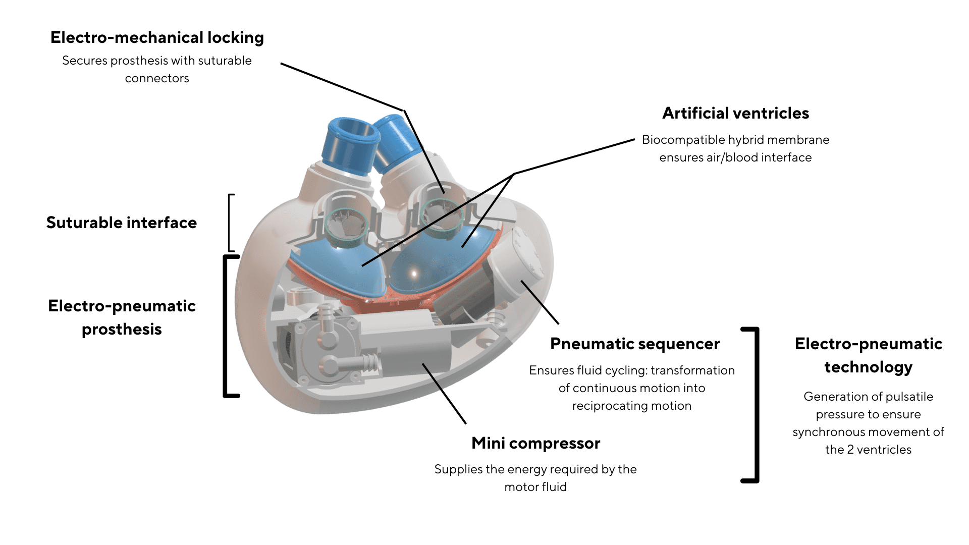 Our artificial heart - Procope Medicals